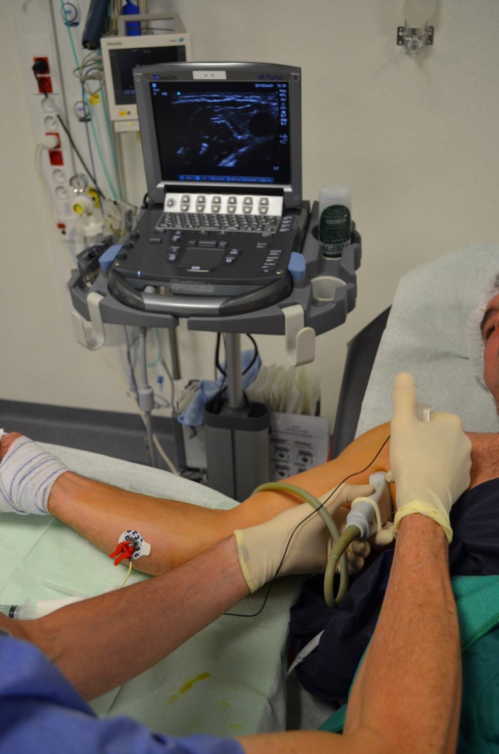 L'Anesthésie - Centre de la Main Orleans